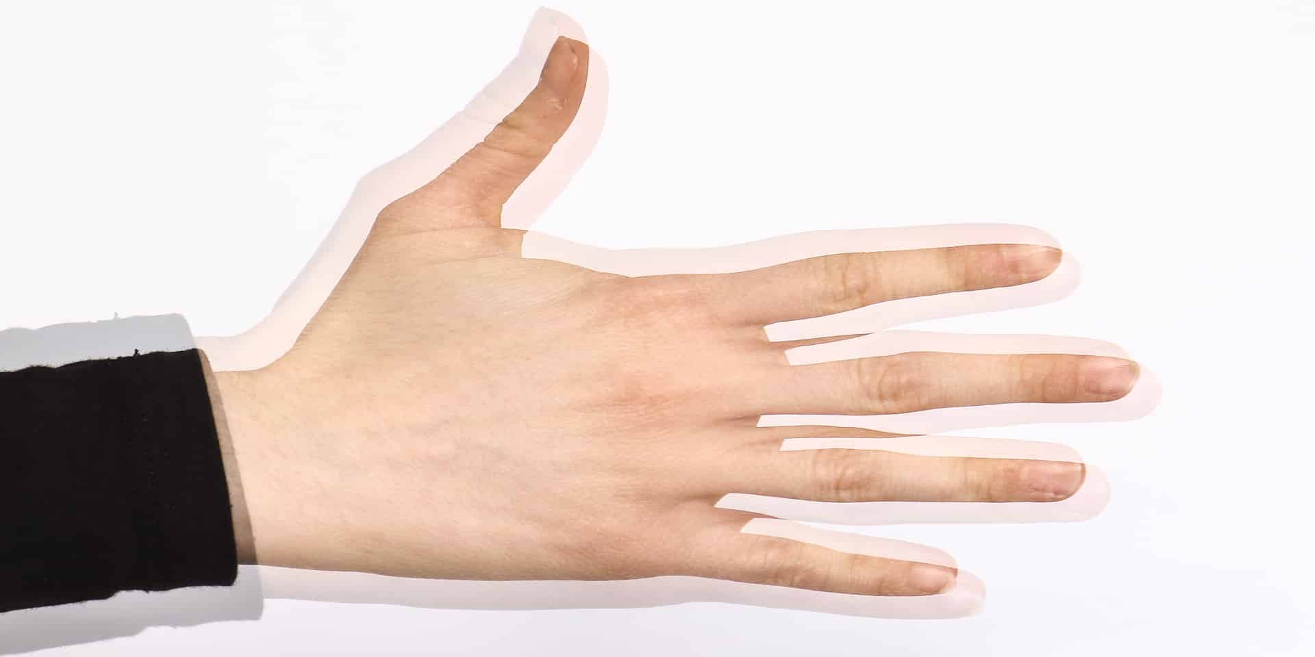 Diplopía o visión doble: causas y tratamiento | Blog de OftalmoSalud