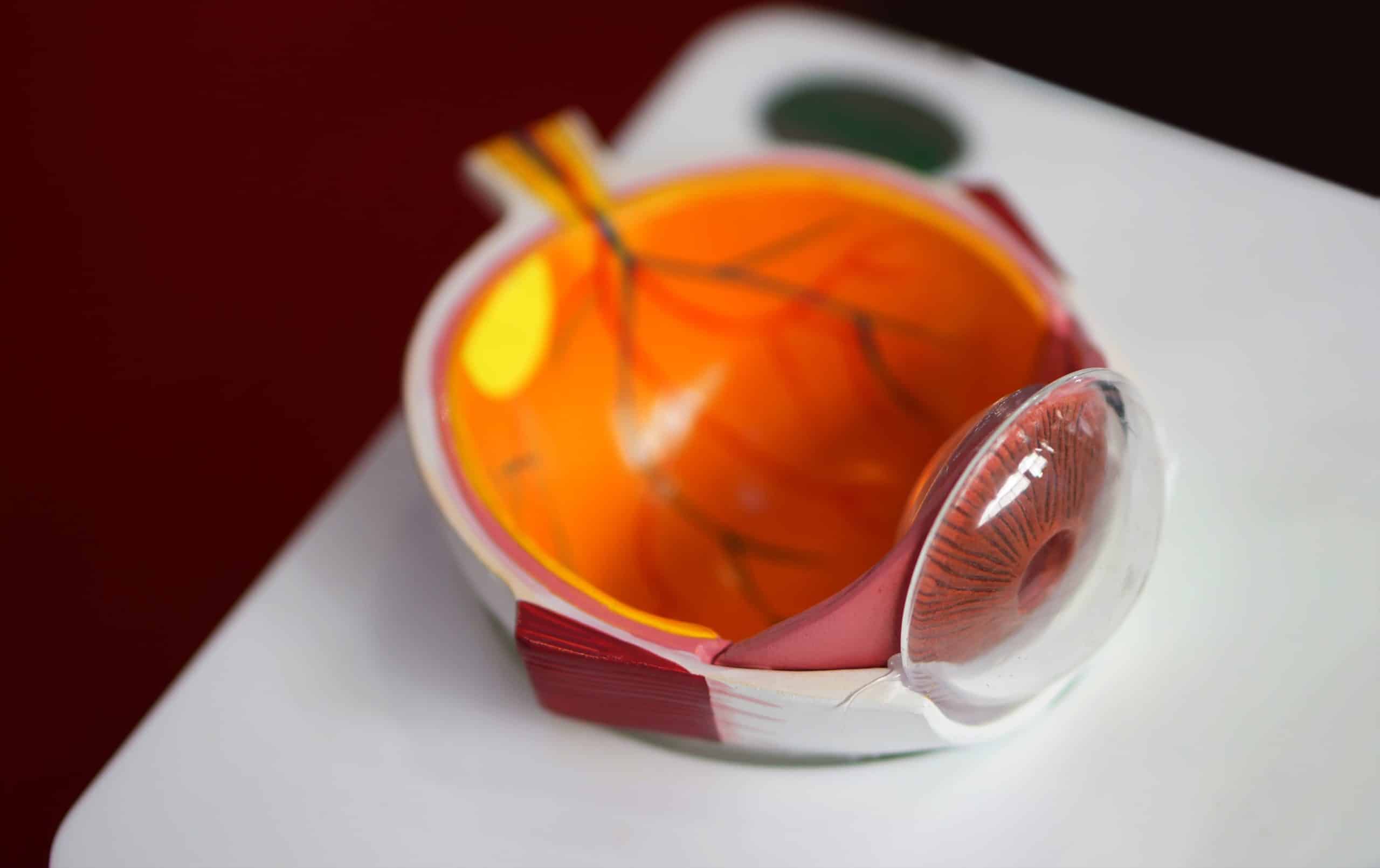 Operación de cataratas: ¿en qué consiste? | Blog de OftalmoSalud