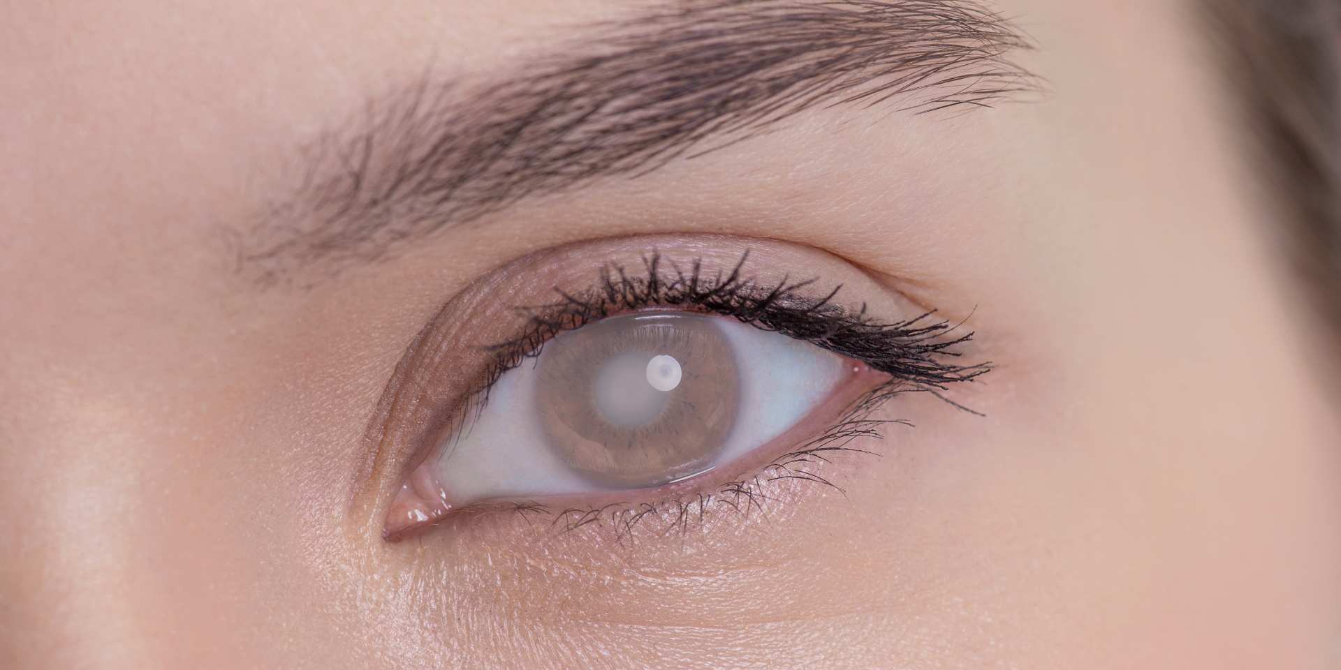 Opacidad del cristalino: ¿cuáles son las causas? | Blog de OftalmoSalud